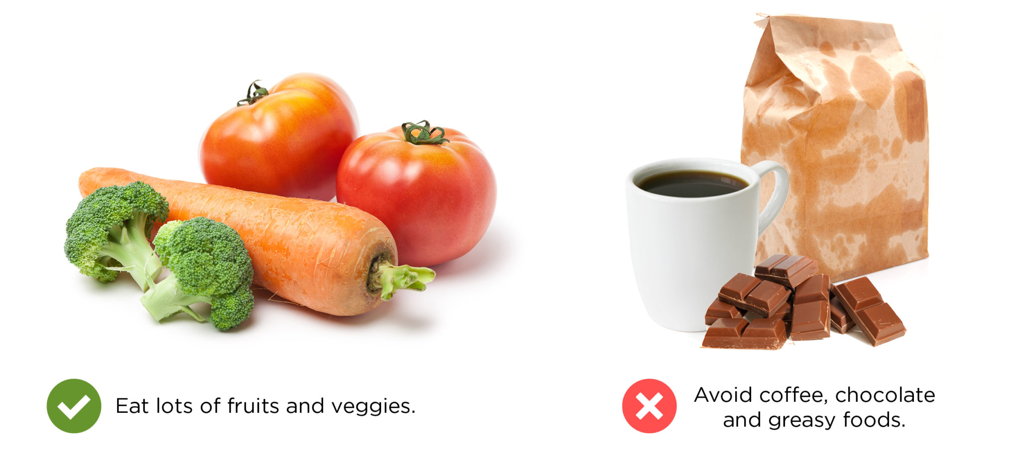 Barrett’s esophagus - AGA GI Patient Center